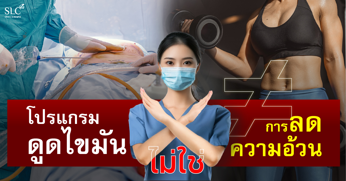 โปรแกรมดูดไขมัน ≠ การลดความอ้วน - SLC Hospital