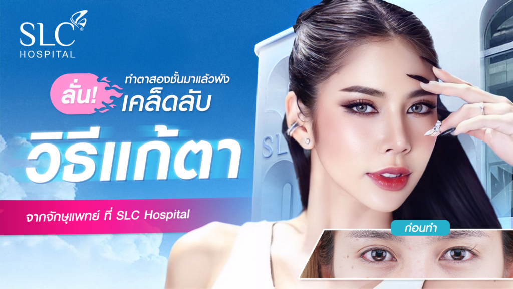 ลั่น! ทำตาสองชั้นมาแล้วพัง เคล็ดลับ วิธีแก้ตาจากจักษุแพทย์ ที่ SLC Hospital